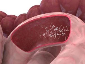 Signs You Might Have a Parasite In Your Body - Geelong Medical & Health ...